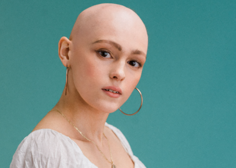 Scalp care brand launches #ItsNotJustHair campaign